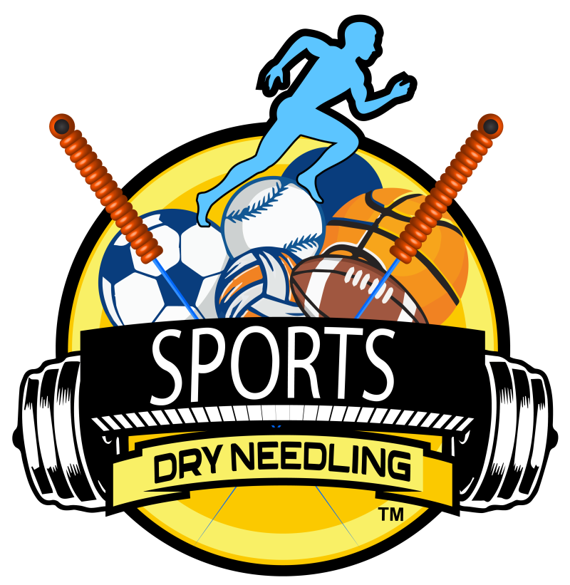 Dry Needling Support Models (1 of 4): The Radiculopathy Model – Sports ...
